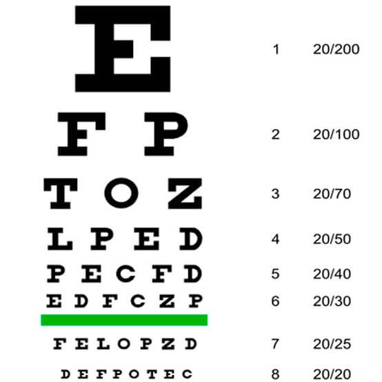 Test Visuales | Oftalmologia Salgado